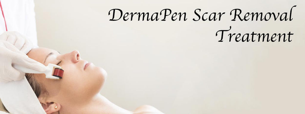 DermaPen Scar Removal | South Woodford | Free Consultation | MAKASkincare
