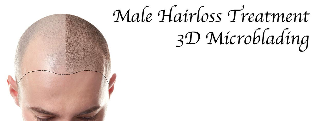 Male Hair Loss Treatment 3D Combination Microblading | South Woodford ...